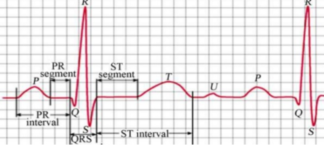 CURSO RÁPIDO DE ECG E GASOMETRIA ARTERIAL